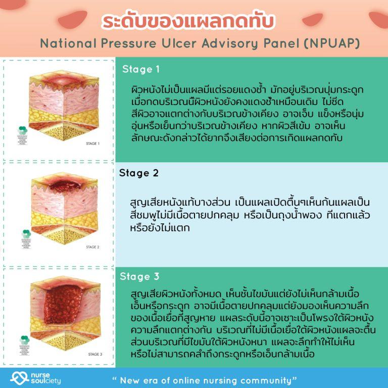 การประเมินแผลกดทับ - Nurse Soulciety